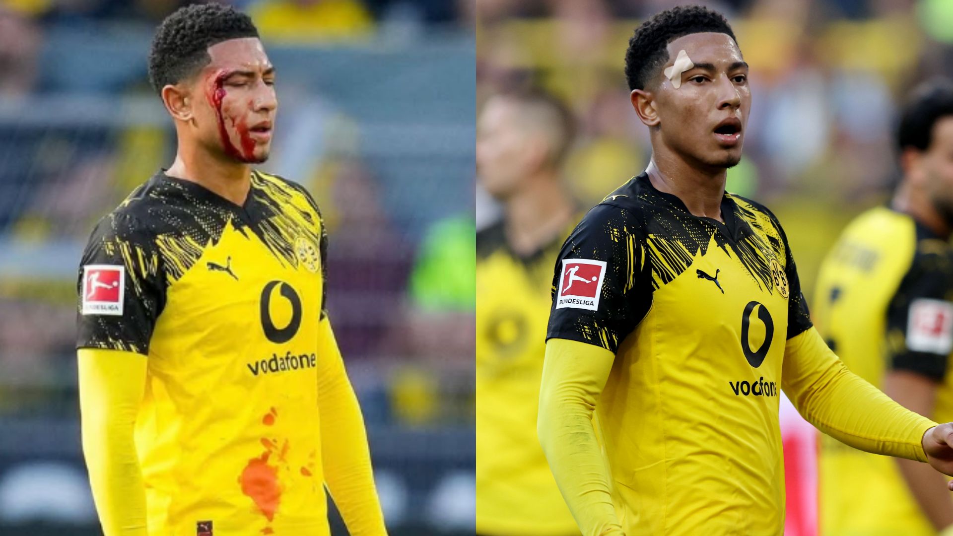 Jobe Bellingham left soaked in blood after nasty collision with Andrej Ilic in Borussia Dortmund ...